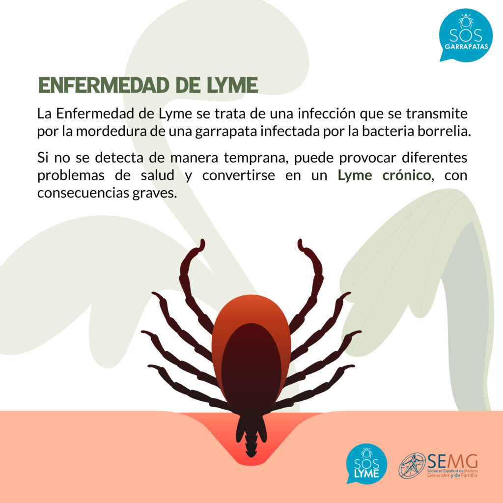 Eritema Migratorio de la Enfermedad de Lyme | SOSLYME